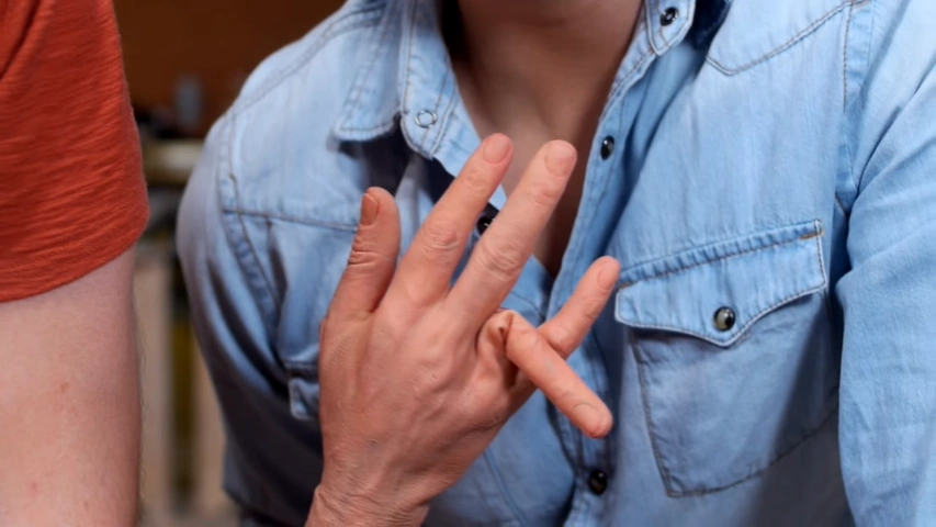 DISLOCATED FINGER! | JesseAndMike Wiki | Fandom