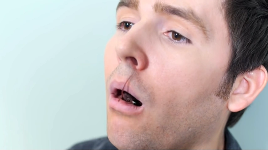 COCKROACH IN MOUTH! | JesseAndMike Wiki | Fandom