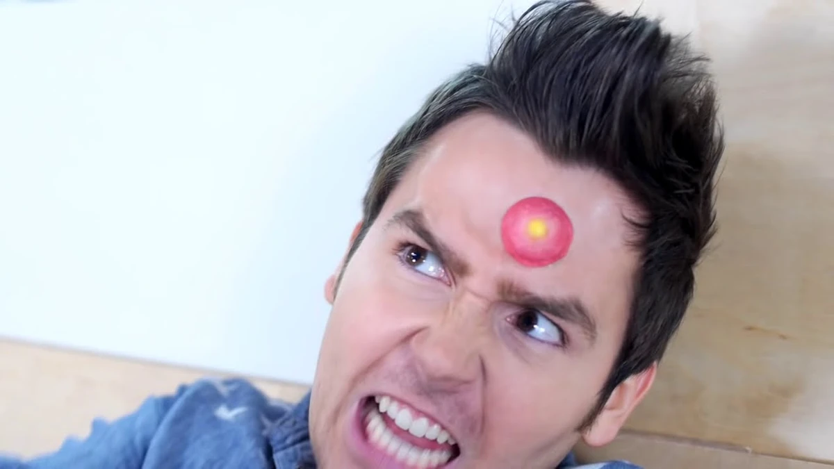 GIANT PIMPLE! | JesseAndMike Wiki | Fandom