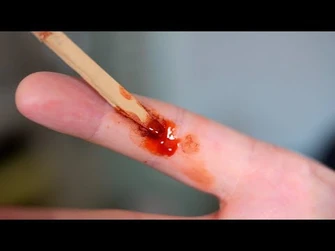 PAINFUL SPLINTER! | JesseAndMike Wiki | Fandom