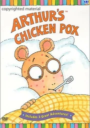 Arthur's Chicken Pox (home media) | Jordanrodriguez Wiki | Fandom