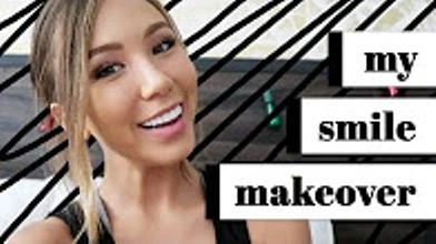 My smile makeover | Kalel Wiki | Fandom