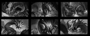 Baron Nashor (Character) | League of Legends Wiki | Fandom