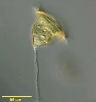 Vorticella citrina | Lepton Wiki | Fandom