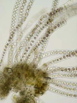 Bangia atropurpurea | Lepton Wiki | Fandom