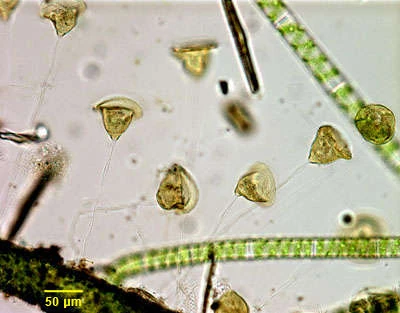 Vorticella citrina | Lepton Wiki | Fandom