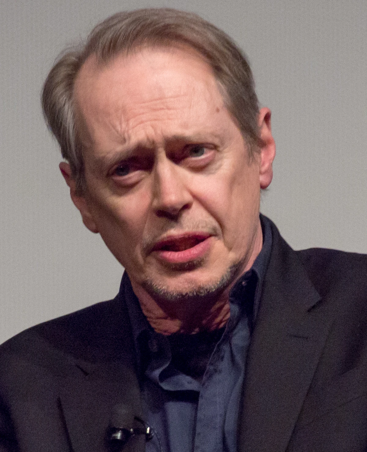 Steve Buscemi Teeth Fixed