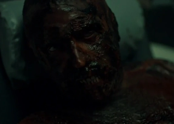 Frederick Chilton (Hannibal TV Show) | List of Deaths Wiki | Fandom