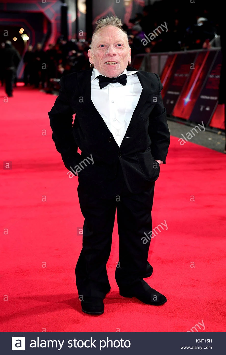 Jimmy Vee | Little Joseph Wiki | Fandom