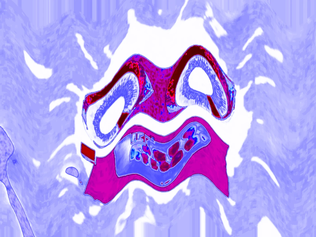 Videoup V10 | Logo Editing Wiki | Fandom