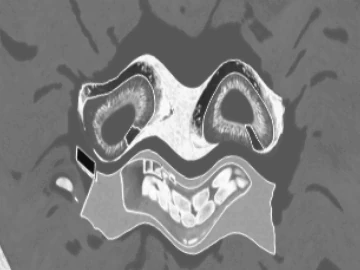 Oh Rats!!! (effect) | Logo Editing Wiki | Fandom