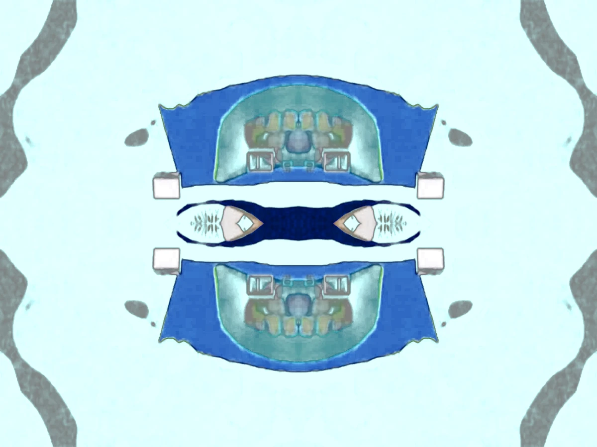 韭 | Logo Editing Wiki | Fandom