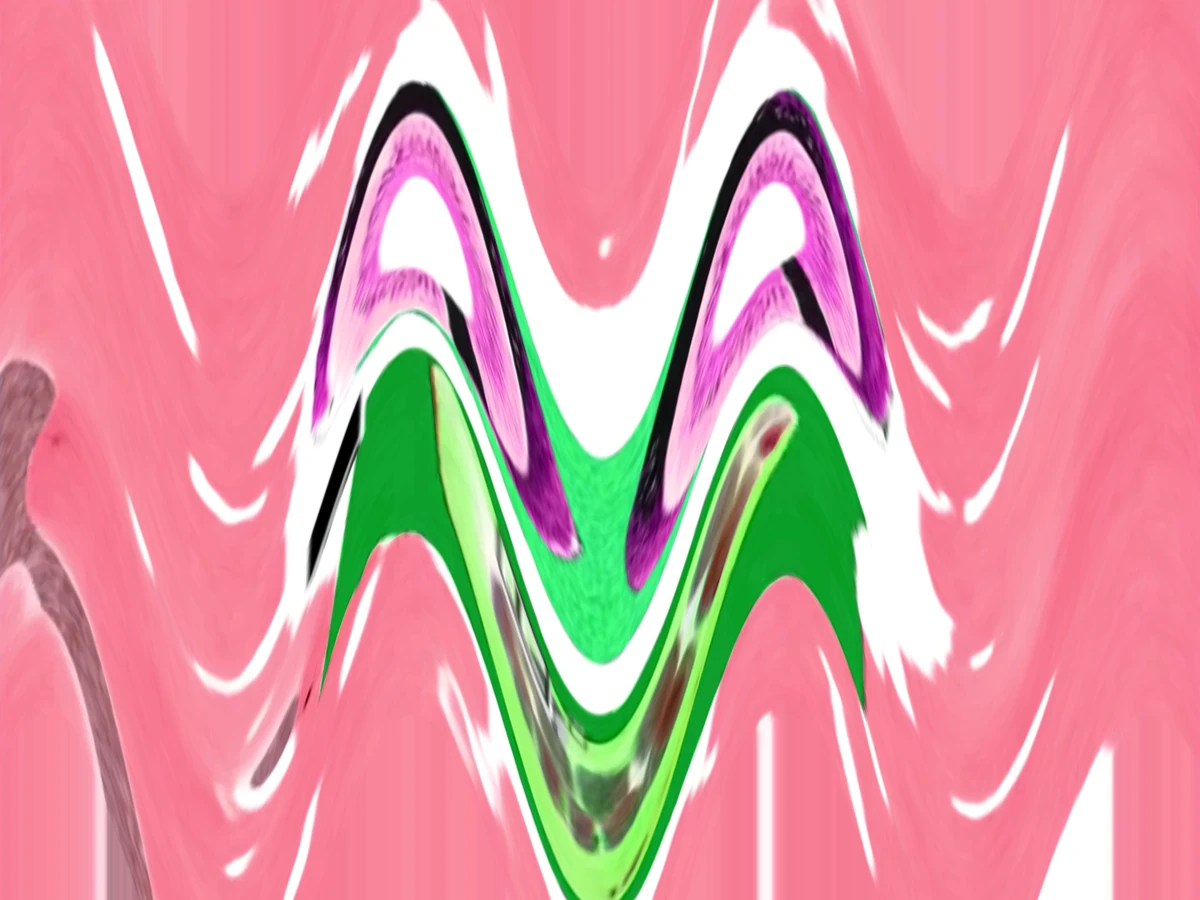 X is So Excited | Logo Editing Wiki | Fandom