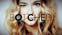Botched | Logopedia | Fandom