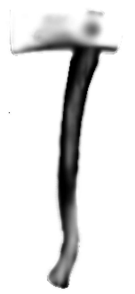 Destroyed Axe | LT2 Fanon Wiki | Fandom