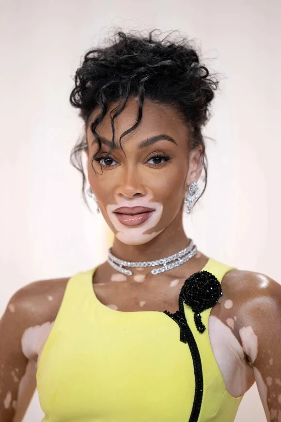 Winnie Harlow | Marvel Cinematic Universe Wiki | Fandom