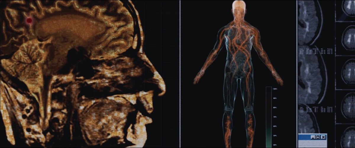 Extremis | Gallery | Marvel Cinematic Universe Wiki | Fandom