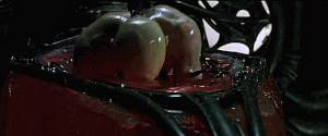 Neo, removing his feeding tube