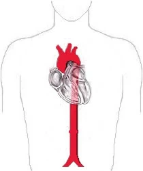 Aorta | Medipedia Wiki | Fandom