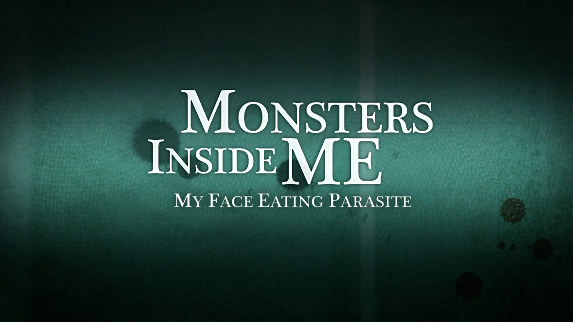 My Face-Eating Parasite | Monsters inside me Wiki | Fandom