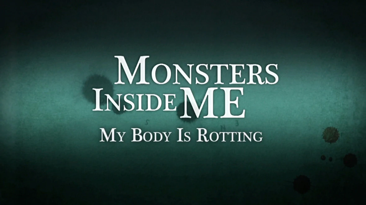My Body Is Rotting | Monsters inside me Wiki | Fandom
