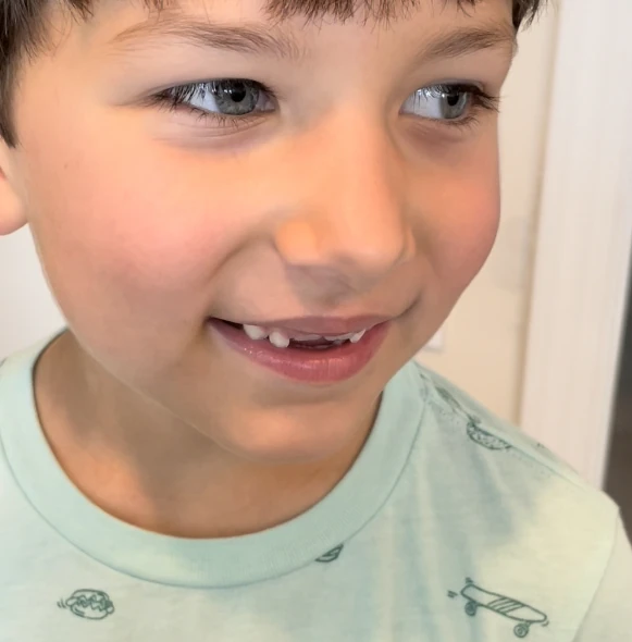 Parker:Gallery | Mooler Tree Wiki | Fandom