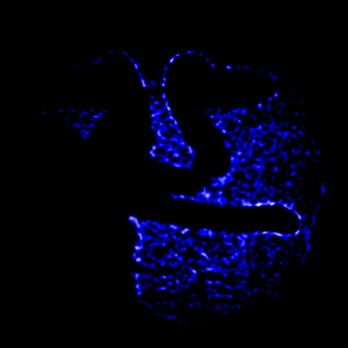 Phase 10000 (Antonius Ziyan) | Mr Incredible Becoming Sad Wiki | Fandom