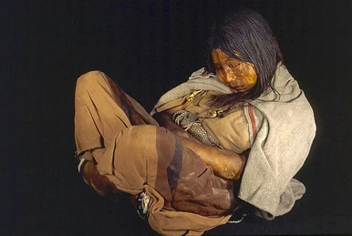 Soap Woman Mutter Museum