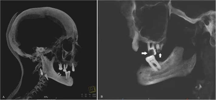 Julius Wilhelm von Crailsheim | Mummipedia Wiki | Fandom