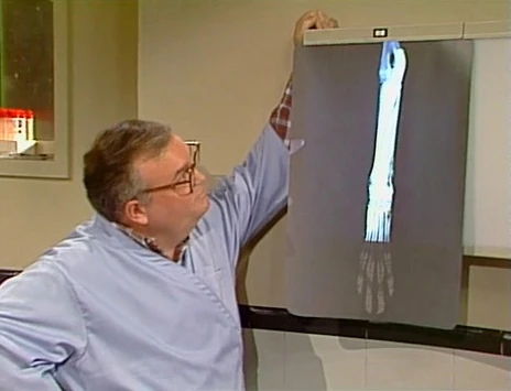 X-rays | Muppet Wiki | Fandom