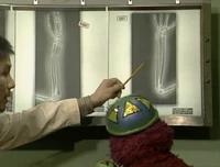 X-rays | Muppet Wiki | Fandom