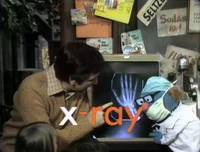 X-rays | Muppet Wiki | Fandom