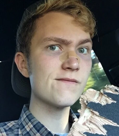 TinkleNipple | Natterunoffical Wikia | Fandom