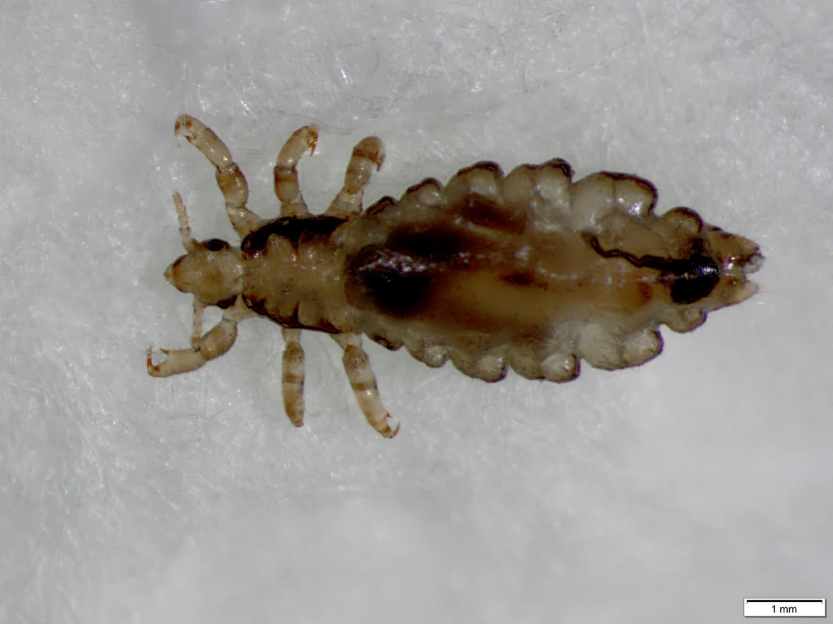 Head Louse | NatureRules1 Wiki | Fandom
