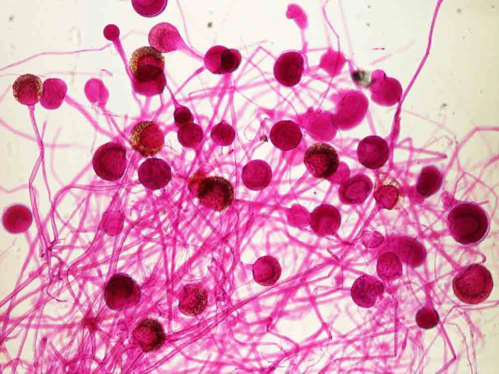 Rhizopus | 식품영양 위키 | Fandom