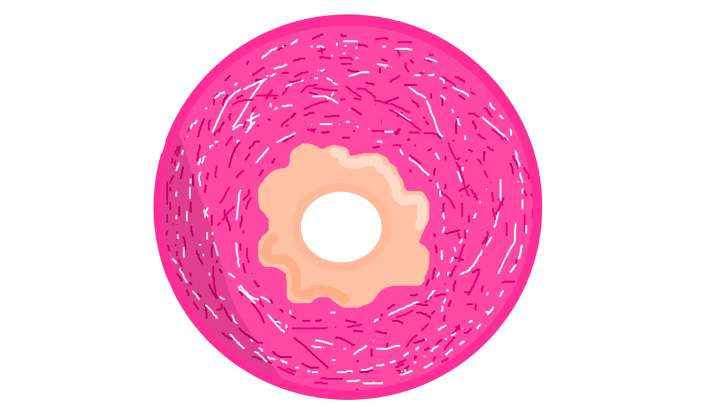 Donut (OM) | Object Ultraverse Wikia | Fandom