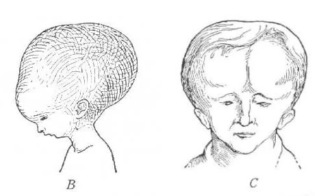 Melonheads | ObscUrban Legend Wikia | Fandom