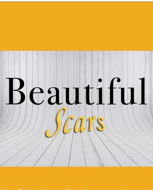 Beautiful Scars | Chloe Lukasiak Wiki | Fandom
