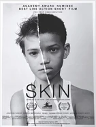 Skin | Oscars Wiki | Fandom