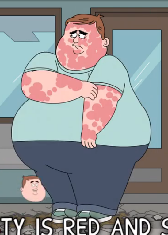 Psoriasis Dusty Paradise Pd Wiki Fandom