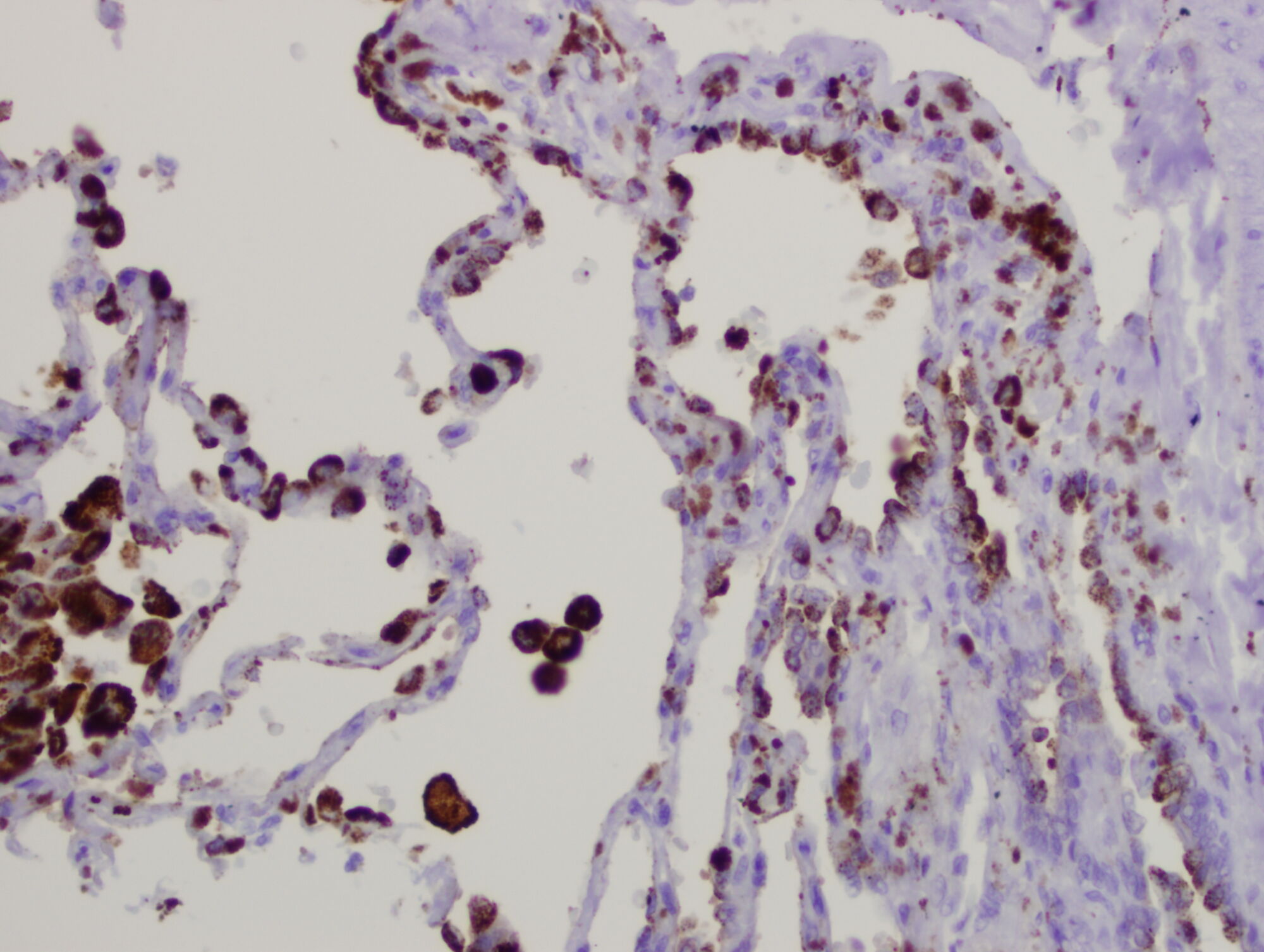 Squamous Cell Carcinoma In Dogs Survival Rate