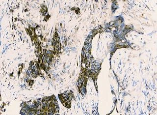 IMP3 | Pathology Resident Wiki | Fandom