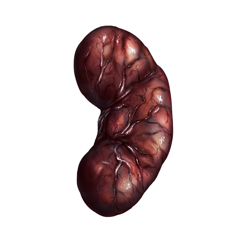 Kidney - Official Pathologic Wiki