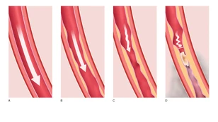 KHK | Pflege Wiki | Fandom