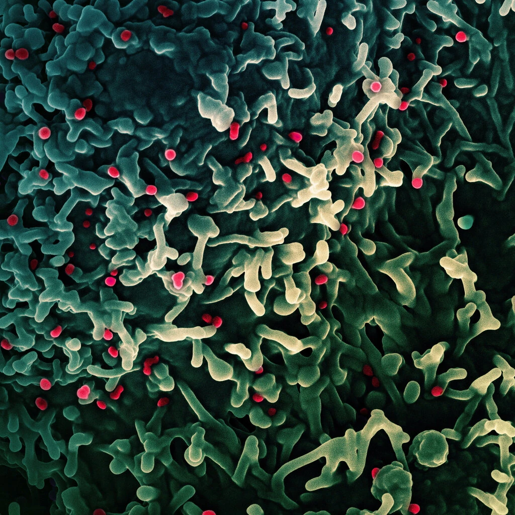 Mpox | PflegeABC Wiki | Fandom