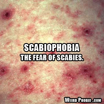 Scabiophobia | Phobiapedia | Fandom