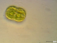 Actinotaenium | Plants Wiki | Fandom