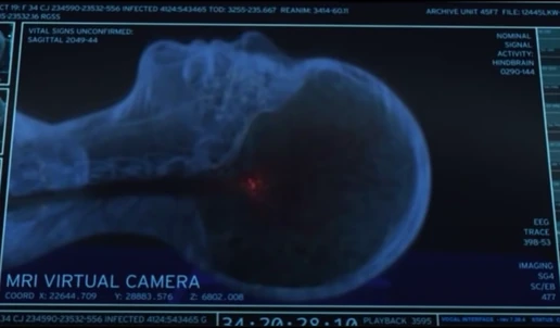 Brain Restarting | Superpower Wiki | Fandom