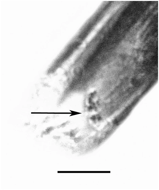 Bubonic plague-like bacteria | Prehistoric Wiki | Fandom