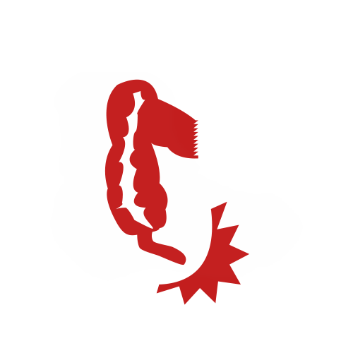 Appendicitis | ProjectHospital Wiki | Fandom